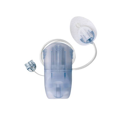 MiniMed™ Mio™ 30 Infusion Set