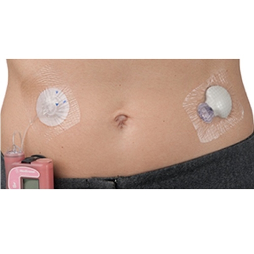 IV 3000™ Transparent Dressing (100PK) (Smith & Nephew, Inc)